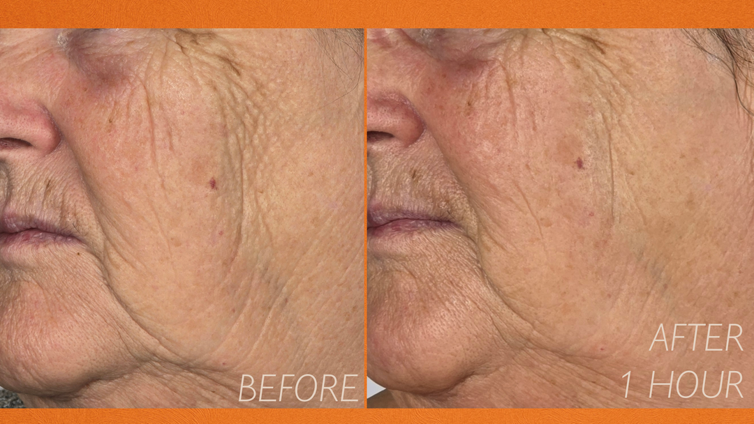 ELYSIUM VISCERO-DERMAL – L(A)B=LIFE+BEAUTY