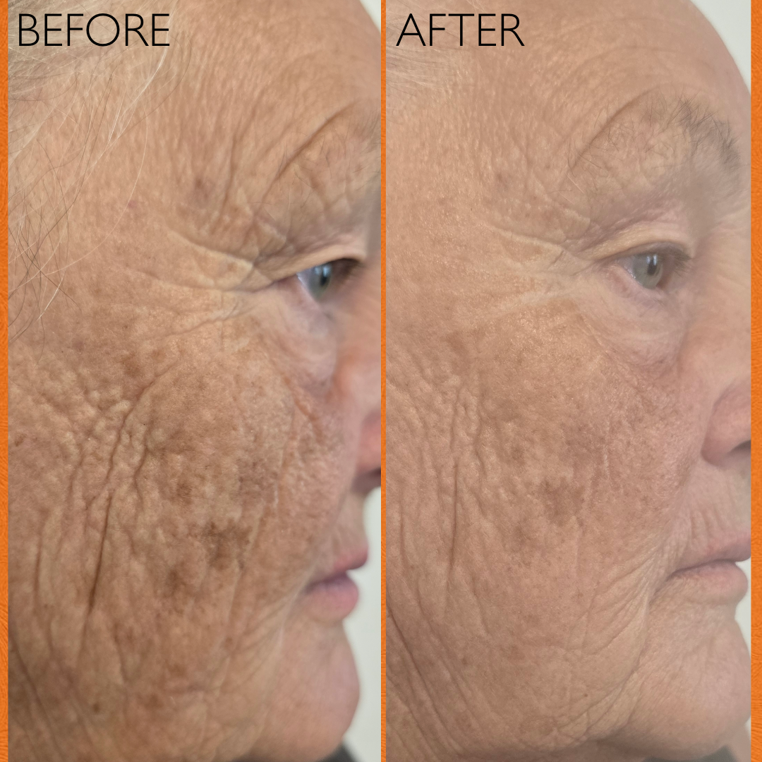 DECIEM – L(A)B=LIFE+BEAUTY