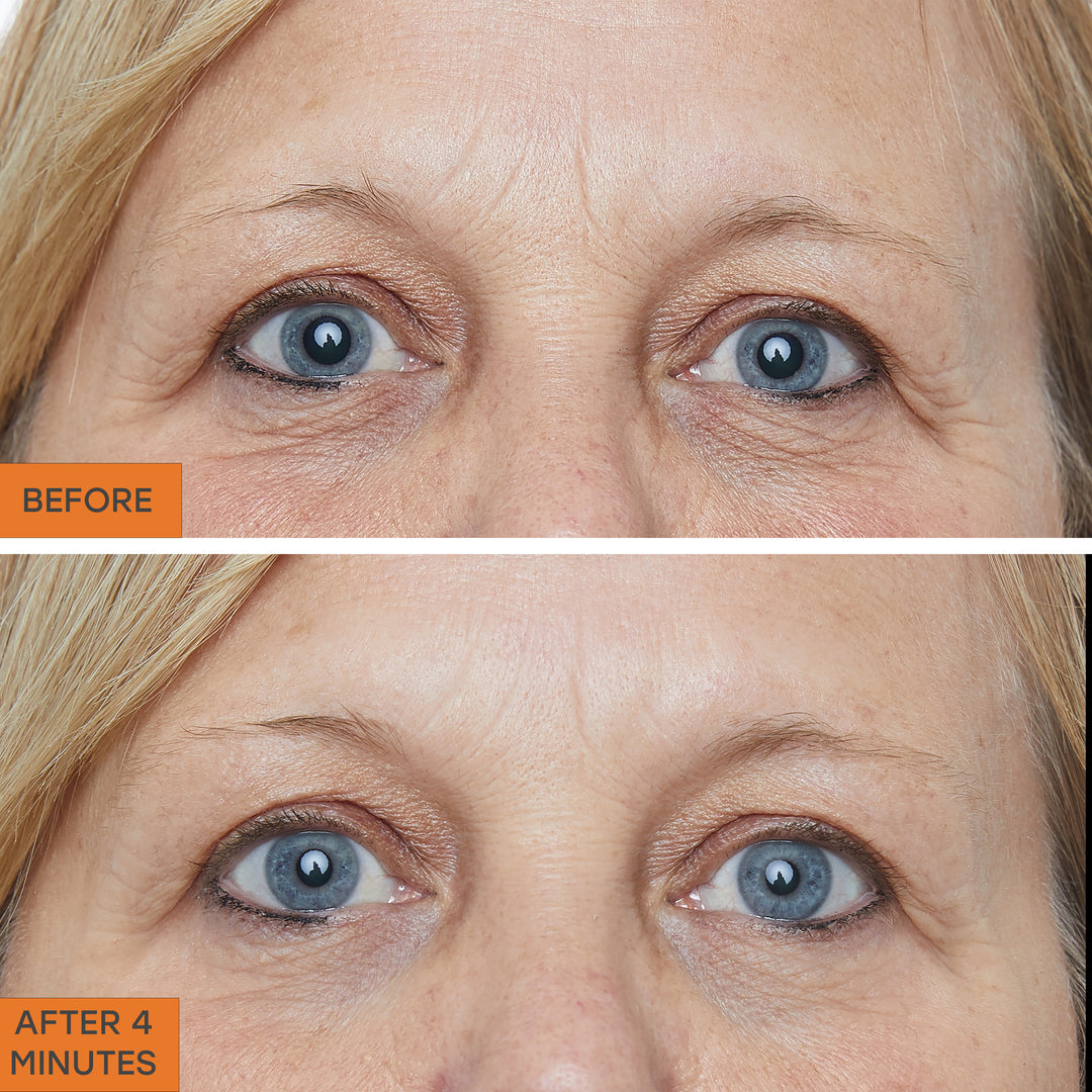 PHOTON TARGETED RESULTS – L(A)B=LIFE+BEAUTY