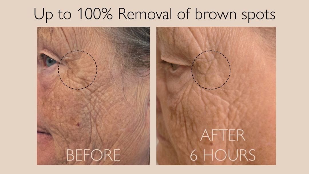POWER PATCHES – L(A)B=LIFE+BEAUTY