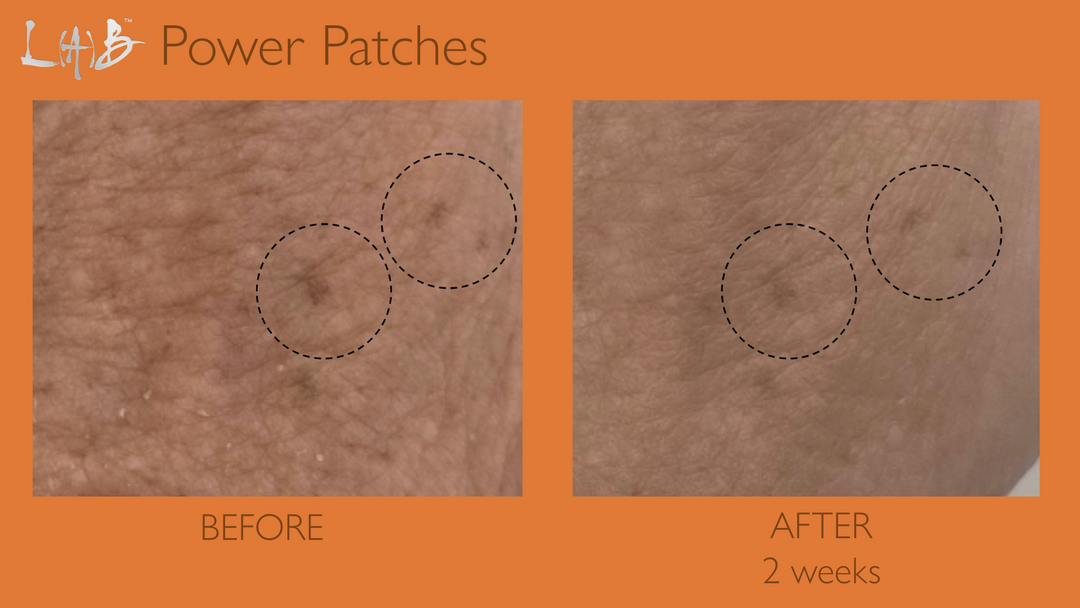 POWER PATCHES – L(A)B=LIFE+BEAUTY