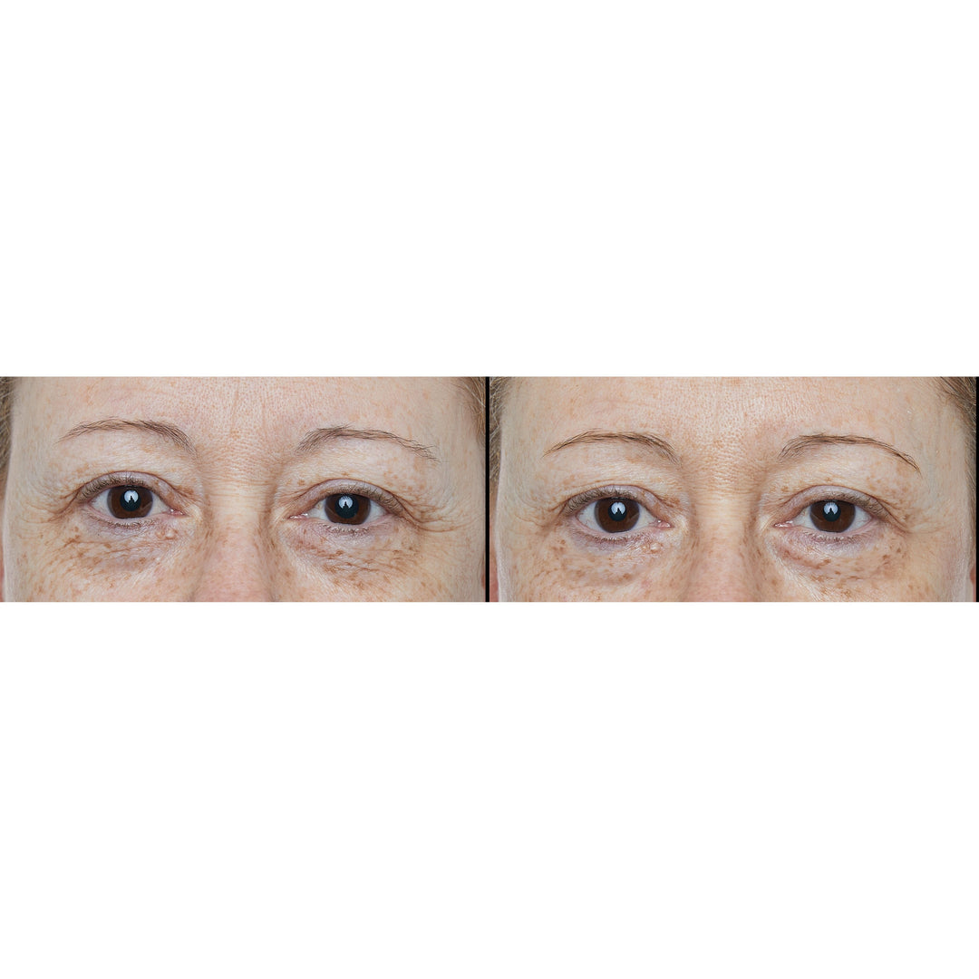 PHOTON TARGETED RESULTS – L(A)B=LIFE+BEAUTY