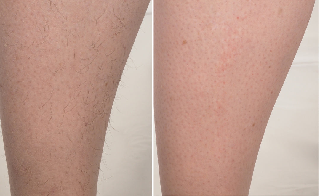 PEBBLE – L(A)B=LIFE+BEAUTY